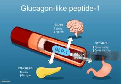 GLP-1 Receptor Agonists - Slender Solutions